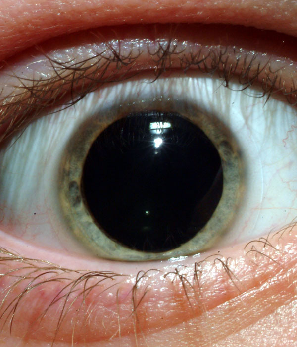 Pupils Dilated Blows My Mind By The Neptunes