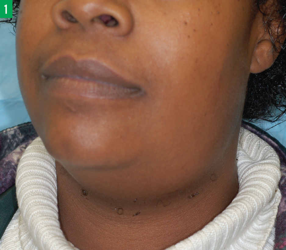 Tmj Enlarged Tmj Enlarged