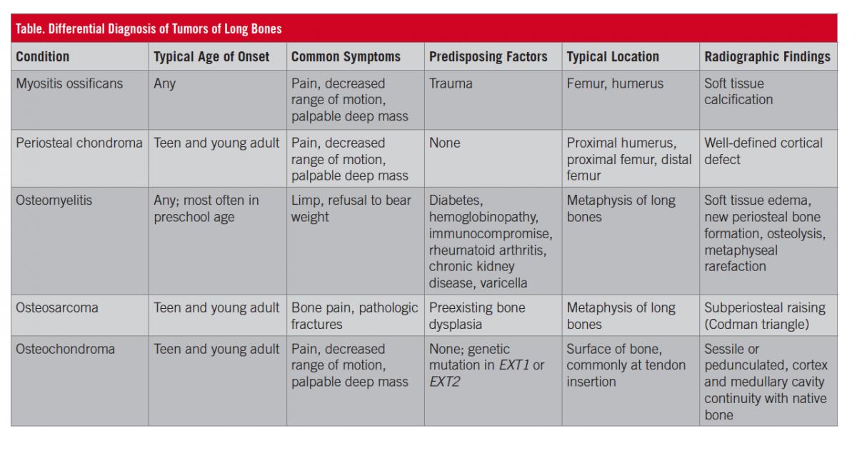 Solitary Osteochondroma | Consultant360