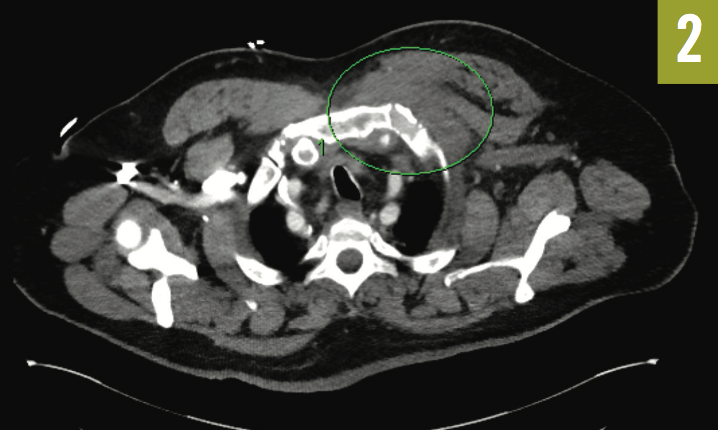A Collection of Conditions Affecting the Lungs | Consultant360
