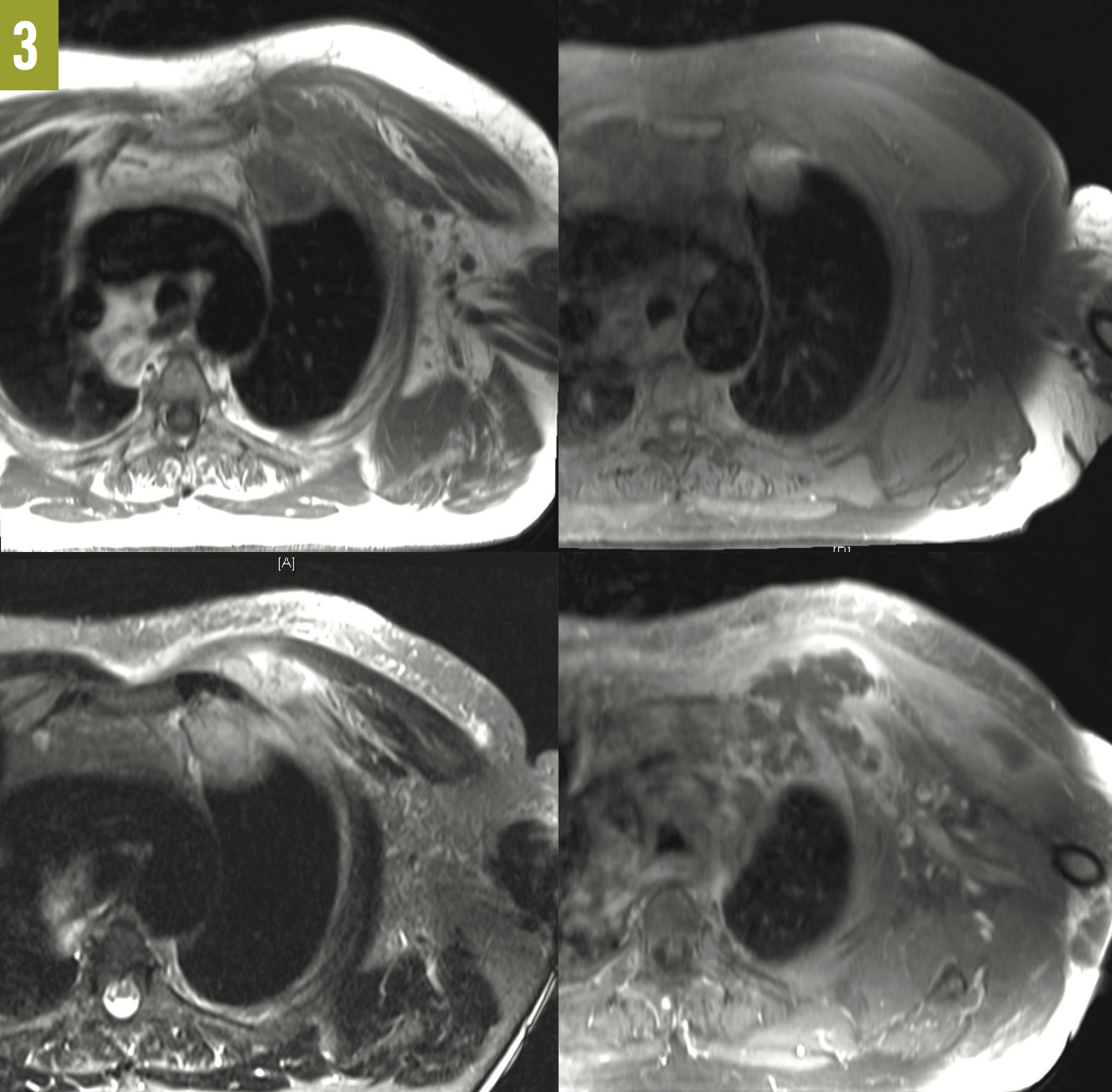 A Collection of Conditions Affecting the Lungs | Consultant360