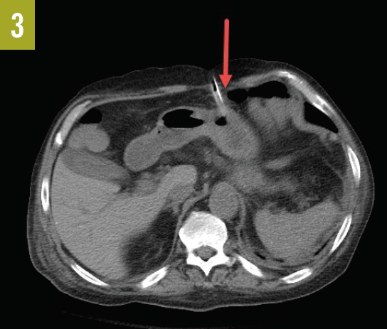 A Collection of Gastrointestinal Disorders | Consultant360