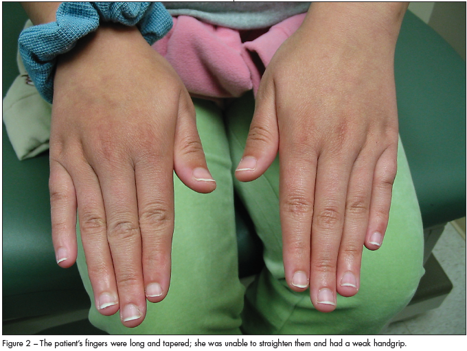 Genetic Disorders: Tetany in a 9-Year-Old Girl | Consultant360