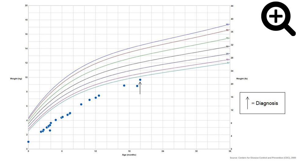 Celiac Disease: Chronic Abdominal Pain and Constipation | Consultant360