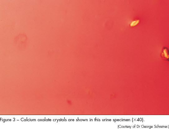 Kidney Disease: A Straightforward Diagnostic Approach | Consultant360