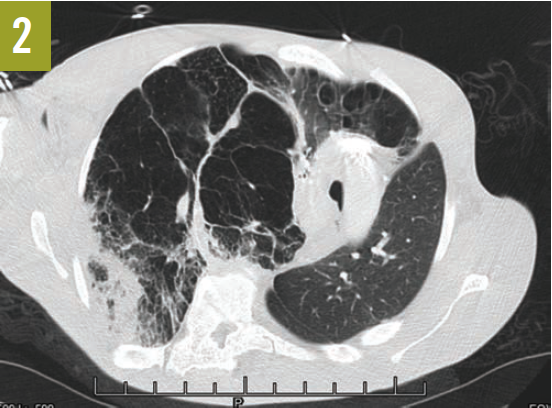 A Collection of Conditions Affecting the Respiratory System | Consultant360