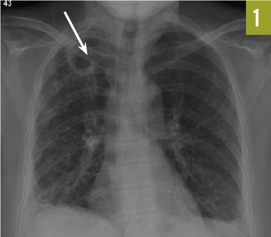 A Collection of Conditions Affecting the Respiratory System | Consultant360