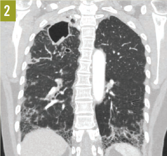 A Collection of Conditions Affecting the Respiratory System | Consultant360