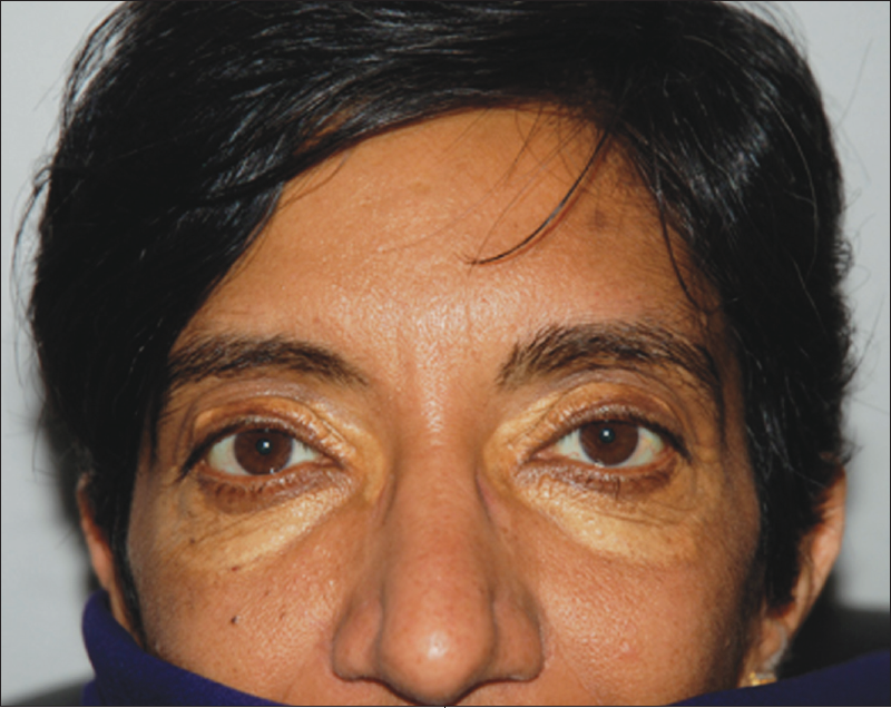 Middle-Aged Woman With Severe Generalized Itchiness and Fatigability ...