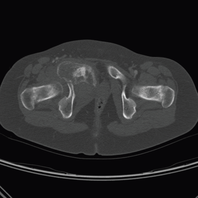 A 9-Year-Old Girl With Knee and Hip Pain | Consultant360