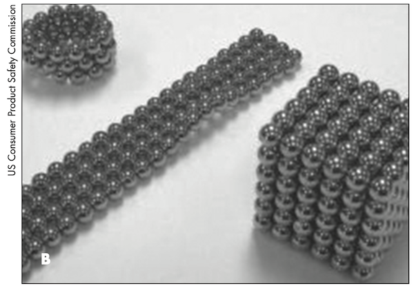 Complications of Multiple Magnet Ingestion | Consultant360