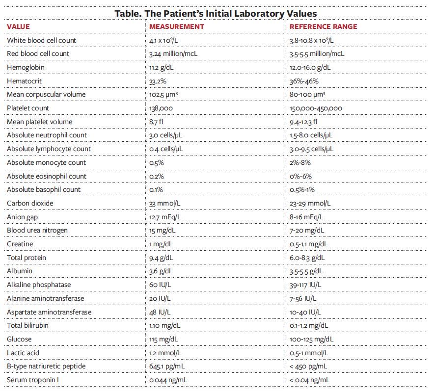 Myxedema Coma | Consultant360