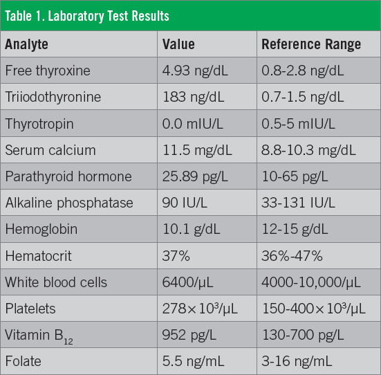 A Woman With New-Onset Psychosis: A Rare Presenting Sign of Thyroid ...