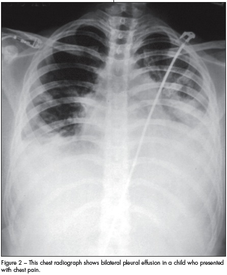 Pediatric Chest Pain: Keys to the Diagnosis | Consultant360