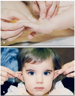 A Collage of Hereditary Childhood Disorders | Consultant360