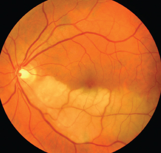 Fundus Medley: 5 Cases | Consultant360