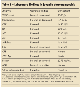 Young Boy With Symmetric Muscle Weakness and Rash | Consultant360