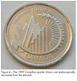 Systemic Nickel Hypersensitivity From a Swallowed Coin | Consultant360