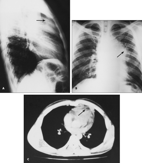 Radiologic Abnormalities and Anomalies | Consultant360