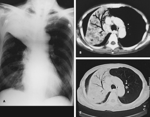 Radiologic Abnormalities and Anomalies | Consultant360