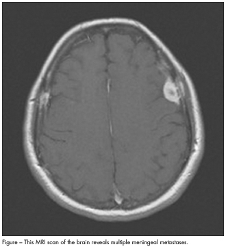 Young Man With a Numb Chin | Consultant360