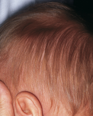 Impact of Trauma | Consultant360