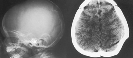 Impact of Trauma | Consultant360