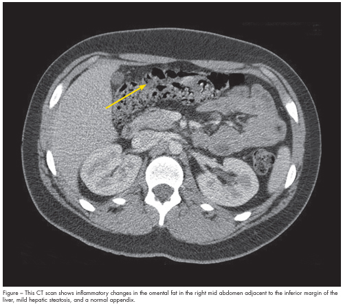 Lower Abdominal Pain in an Obese Teenage Boy | Consultant360