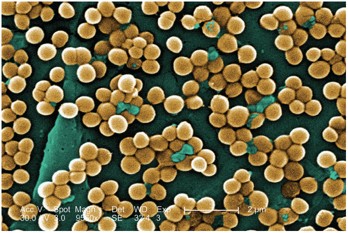 Wound Infection: Primary Considerations | Consultant360