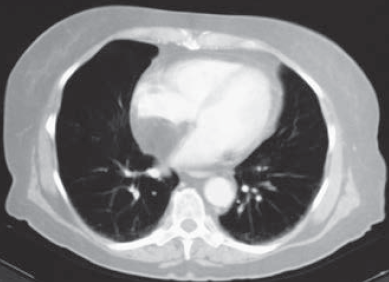 A Look at Cardiometabolic Risk | Consultant360