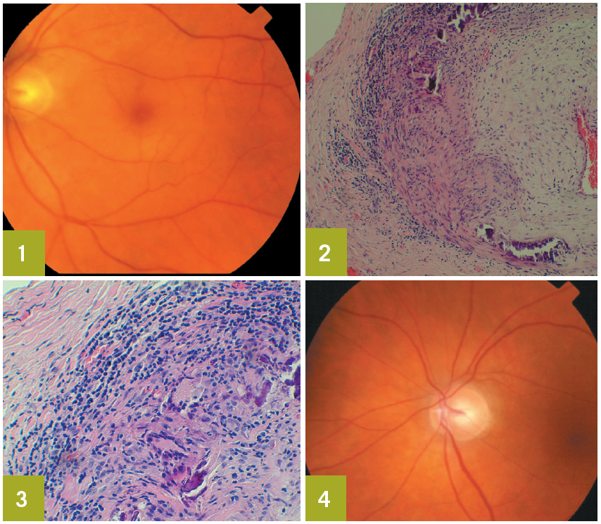 Conditions That Might Affect the Brain | Consultant360