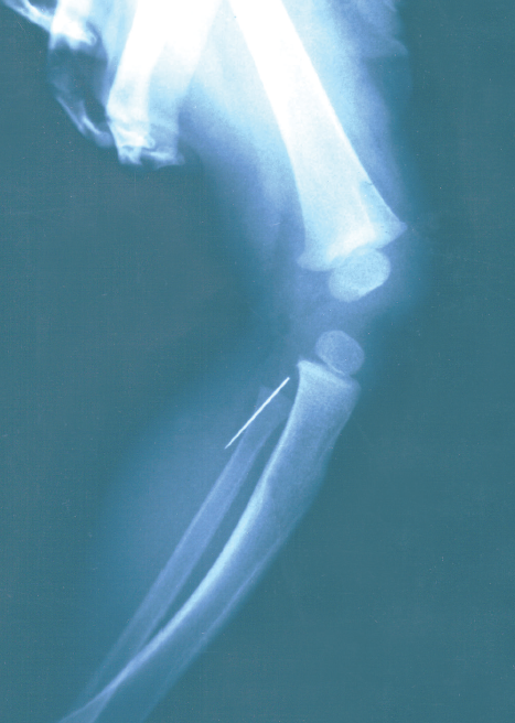 A Collection of Allergic Reactions | Consultant360