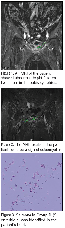 Is It My Chicken? | Consultant360