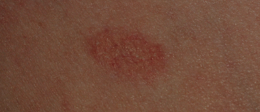 What could be causing her rash? | Consultant360