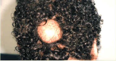 A Collection of Cysts | Consultant360