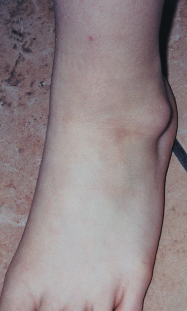 A Collection of Cysts | Consultant360