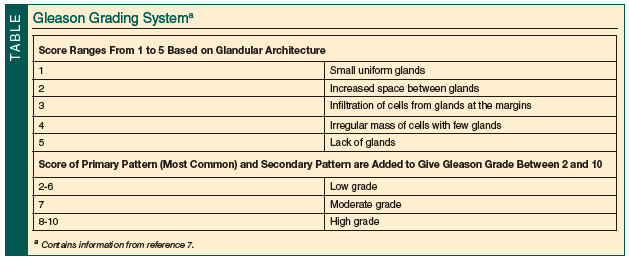 Screening and Management of Prostate Cancer in the Elderly | Consultant360