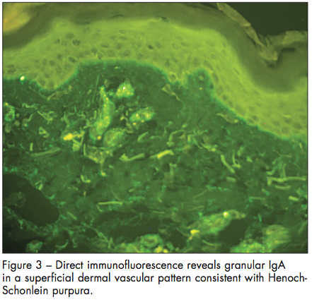 Man With a Diffuse Palpable Rash | Consultant360