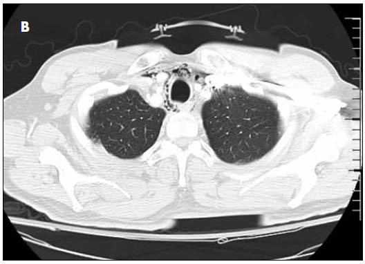 A Case of Concerning Crepitus | Consultant360