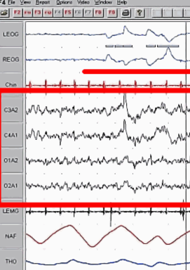 New Brain Test Aids ADHD Diagnosis | Consultant360
