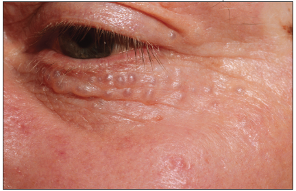 Enhance Your Dermatologic Prowess | Consultant360