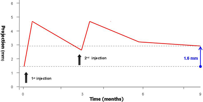 The Efficacy of Artecoll Injections for the Augmentation of Nipple ...