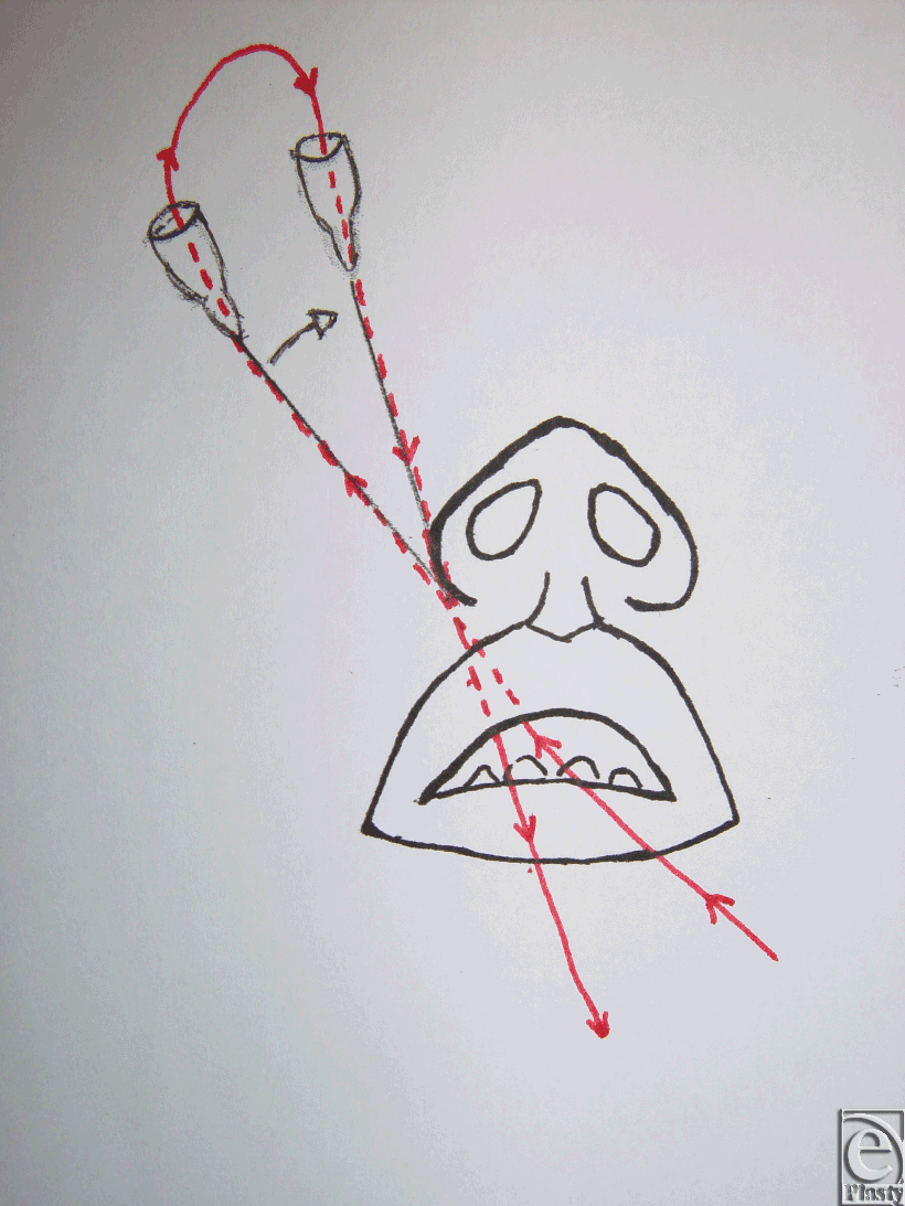 An Alternative Alar Cinch Suture