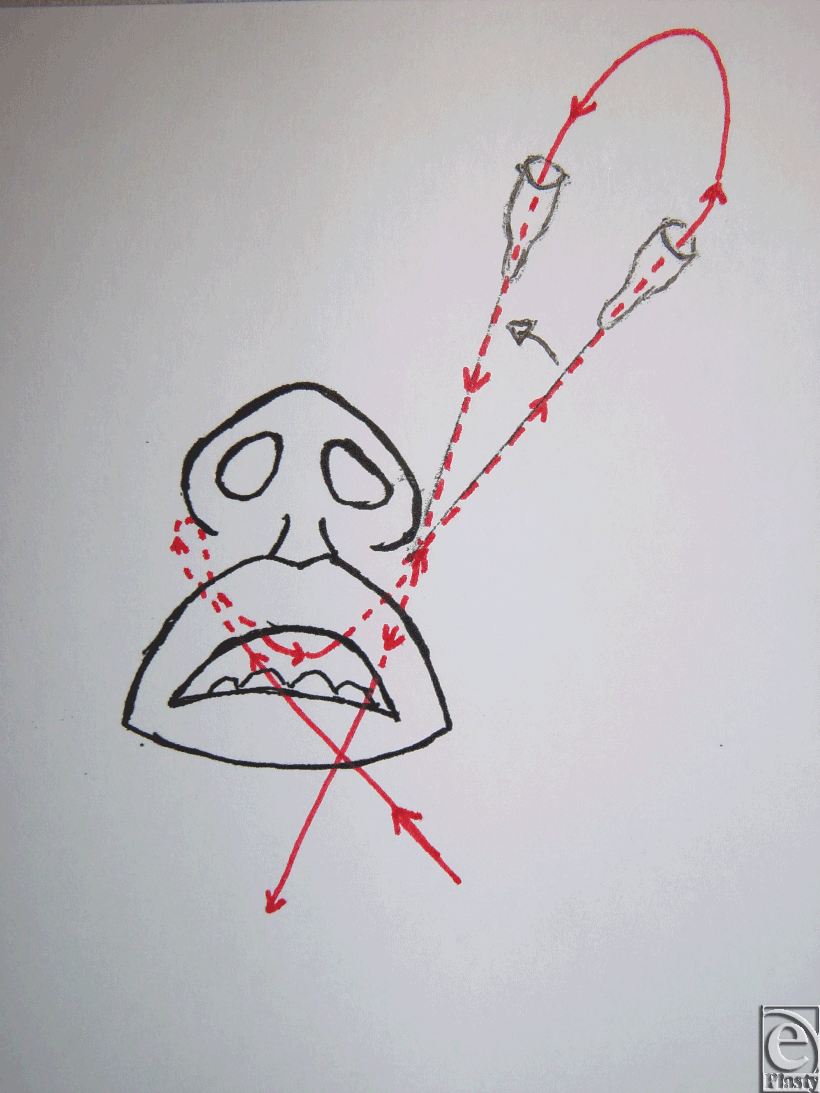 An Alternative Alar Cinch Suture