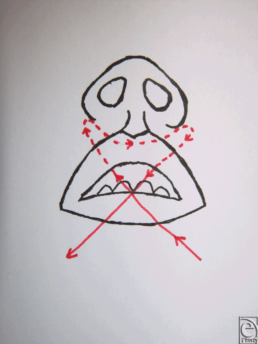 An Alternative Alar Cinch Suture
