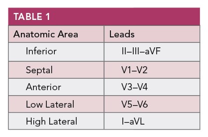 STEMI 2.0