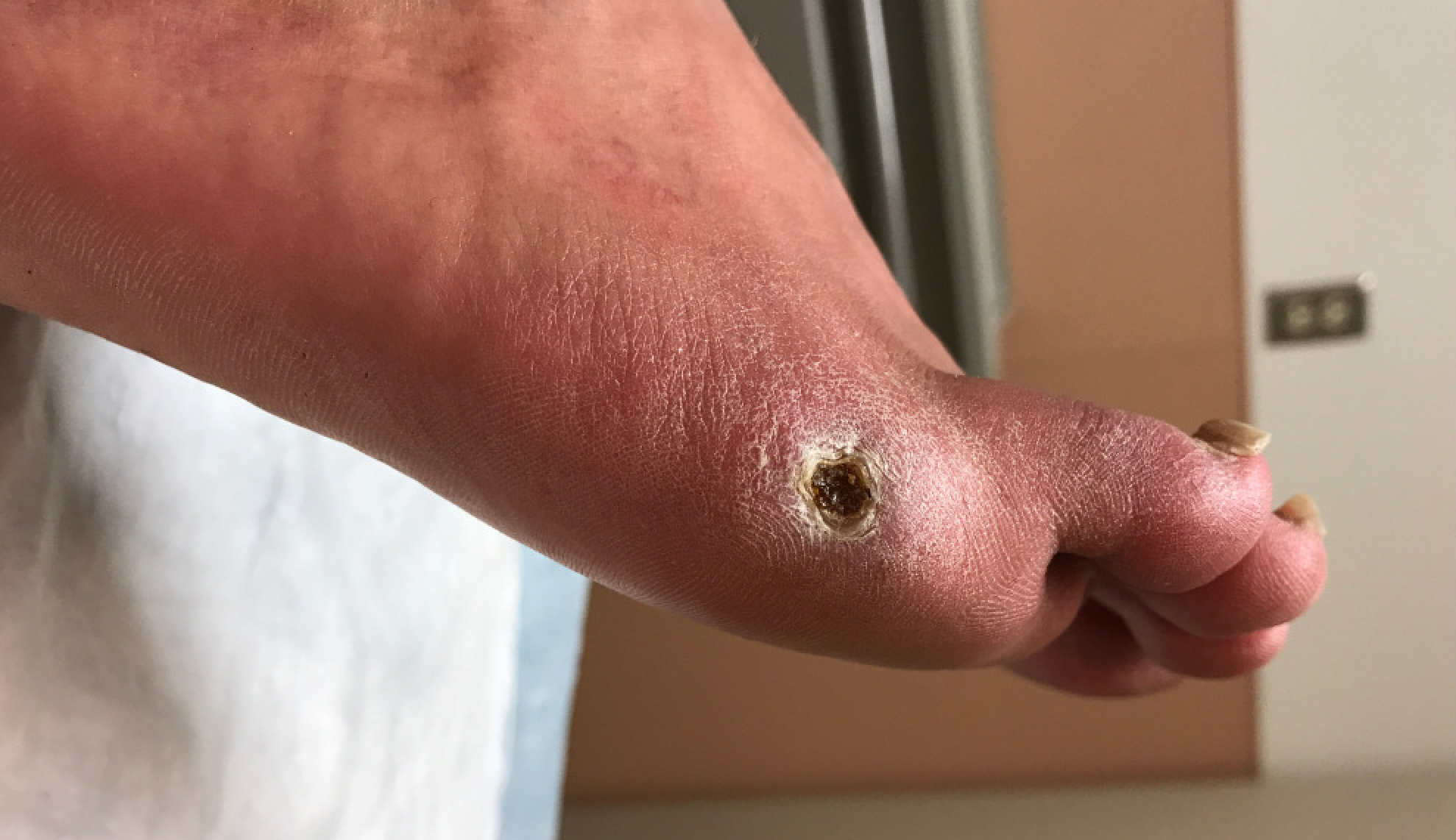 Diseases Caused By Smoking Weed