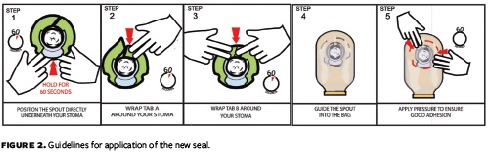 A Single-arm, Practical Application Assessment of User Experience and ...