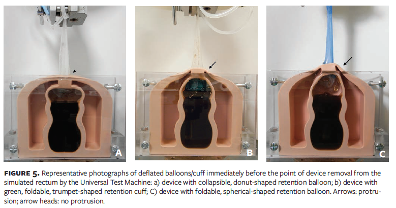Contamination Risk During Fecal Management Device Removal: An In vitro ...