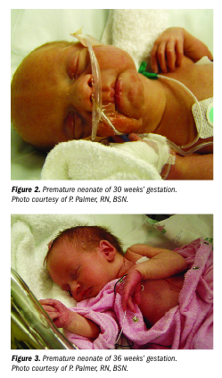 An Overview of Neonatal and Pediatric Wound Care Knowledge and ...